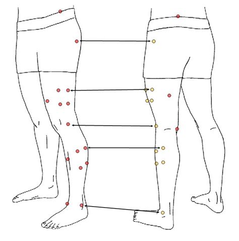 Muscle Activity And Kinematics During Three Hamstring Strengthening Exercises Compared To
