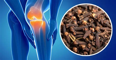 მიხაკის ჩაი სახსრების ტკივილის საწინააღმდეგოდ რჩევები ვივიენისგან