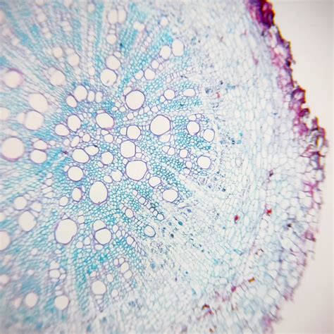 Dicot Root Microscope Anat0919