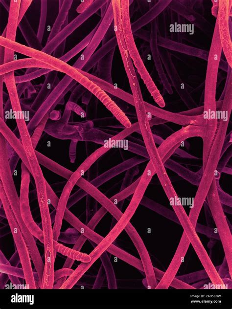 Coloured Scanning Electron Micrograph Sem Of Scytonema Sp Gram Negative Oxygenic