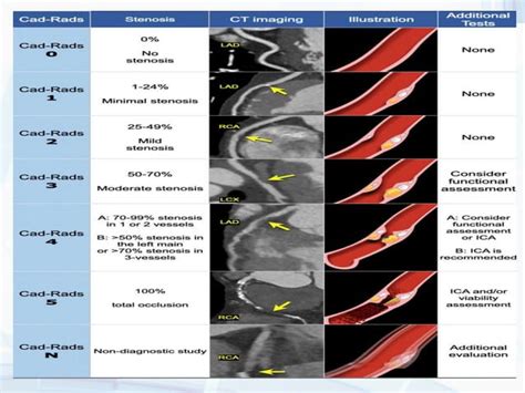 Coronary Classpptx Free Download Coronary Classpptx Free Download