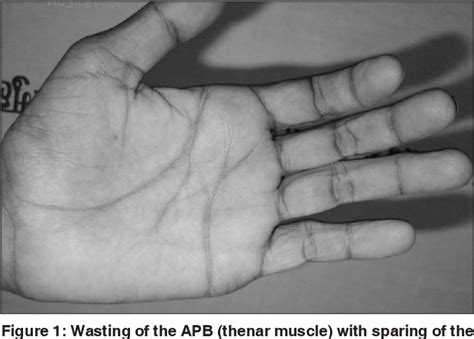 Figure 1 From The Split Hand Sign Semantic Scholar