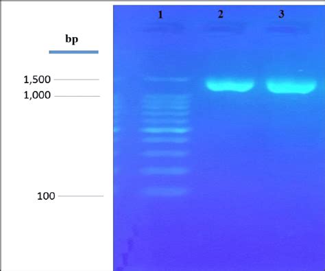 Agarose Gel Electrophoresis Of 16s Rrna Gene Amplified From Isolates