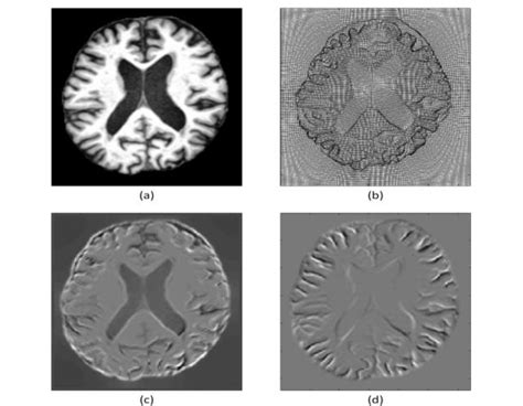 Grids Generated By Setting Intensity Of Mri Brain Images A Original