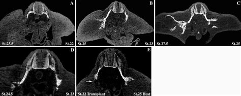 Axons From The Host Embryo Grow Into Donor Limbs Left In Each Panel