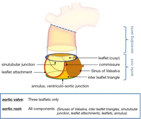 Anatomy Of The Aortic Root Implications For Valve Sparing Surgery Pmc