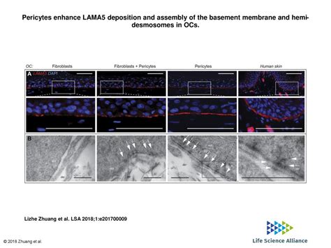 Pericytes Enhance Lama5 Deposition And Assembly Of The Basement