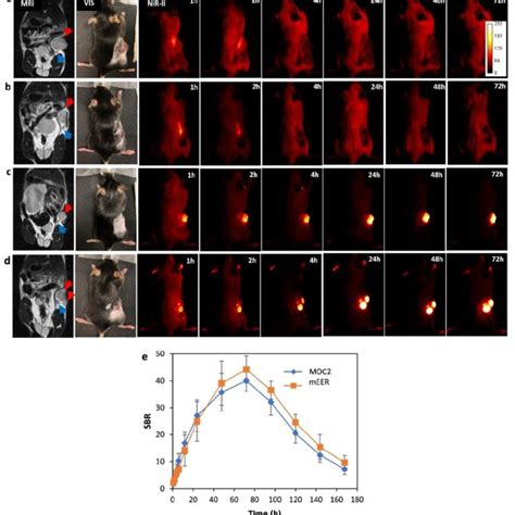 Preoperative Mri And In Vivo Nir Ii Tumor Imaging Nir Ii Imaging With