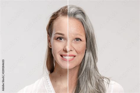 Comparison Portrait Of Beautiful Woman With Problem And Clean Skin