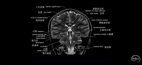 影像解剖 头颅mr冠状面解剖中英文对照 脑医汇
