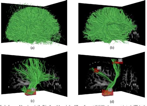Figure 3 From Ieee Transactions On Visualization And Computer Graphics