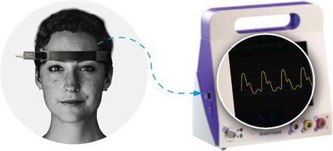 Band Connected To Brain4cares Non Invasive Icp Measuring Device