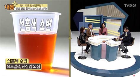 소변 색깔로 보는 질병 현재 내 몸의 건강 상태