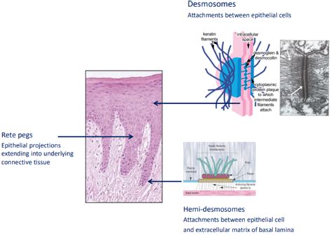 Pdtcp Desquamative Gingivitis Flashcards Quizlet