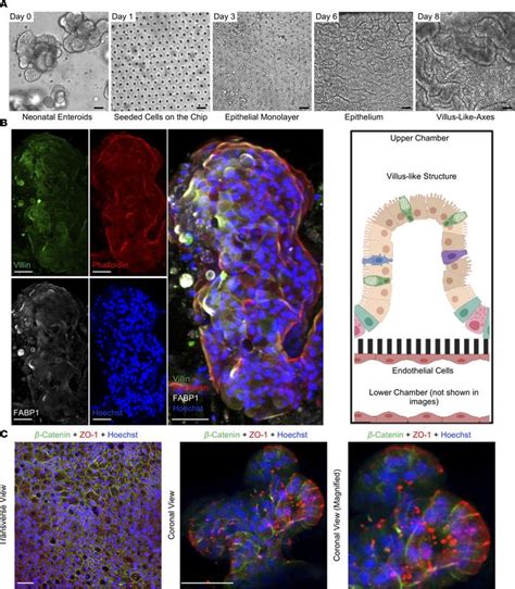 Jci Insight Microfluidic Device Facilitates In Vitro Modeling Of
