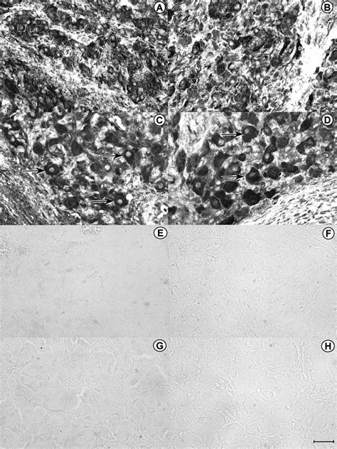 Light Micrographs Illustrating Immunolocalization Of Mmp 9 In Ovine