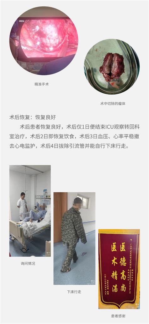 医疗3d打印3d技术助力广东省人民医院赣州医院泌尿外科高难度肿瘤手术