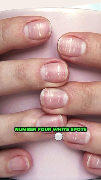 7 Things Your Nails Can Tell You About Your Health Youtubeshorts