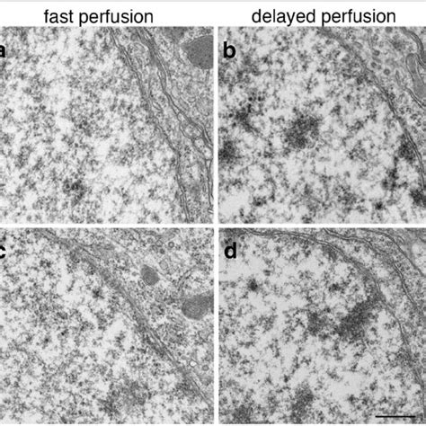 Er Cisternal Stacks Arrows In B C Were Absent In Neuronal Somas Download Scientific Diagram