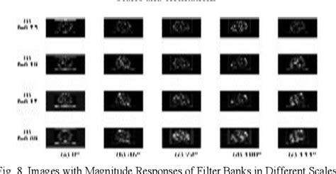 Figure 1 From Brain Tumor Detection And Classification By Mri Using