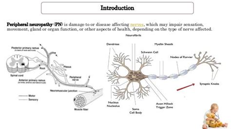 Giant Axonal Neuropathy