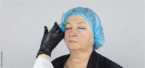 Botulinum Toxin Injection Senior Woman At The Appointment With A