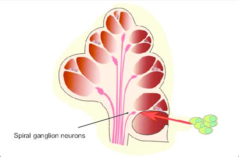 Cell Transplantation Into The Cochlear Modiolus Download Scientific