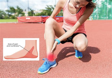 Tarsal Tunnel Syndrome I Nyeri Pergelangan Kaki Penyebab Gejala Dan