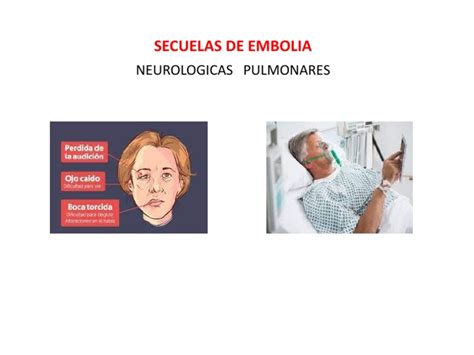 Secuelas De Embolia Pdf