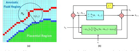 Figure 3 From Automated Placental Abruption Identification Using