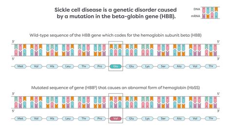 Sickle Cell Snp Mutation In The Beta Globin Hbb Gene Graphic