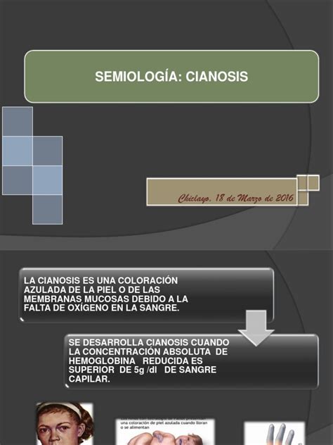 Semiología De La Cianosis Pdf