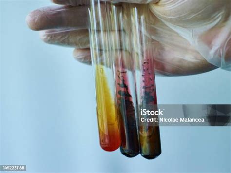 다양한 박테리아 배양 배지 시험관 미생물학 실험실 테스트 Stem 주제에 대한 스톡 사진 및 기타 이미지 Stem 주제 건강 진단 건강관리와 의술 Istock