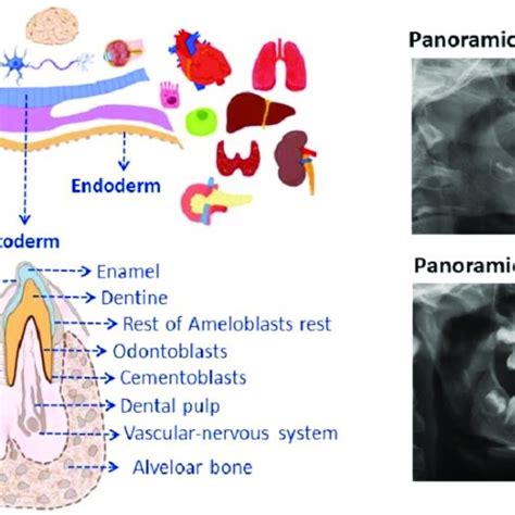 Development Of Germinal Layers Ectoderm Mesoderm And Endoderm Left Download Scientific