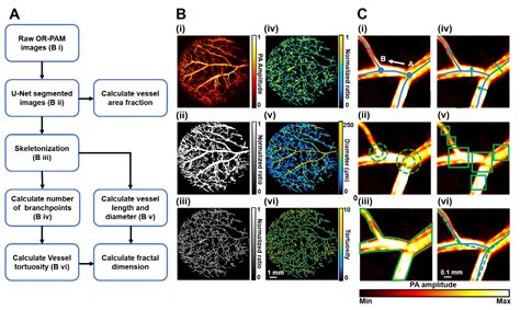 南科大多功能光学影像实验室本科生赵元龙在光学期刊Biomedical Optics Express发表研究成果 深圳市智能医学工程重点实验室