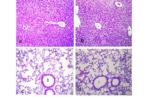 photomicrographs of hematoxylin eosin stained mice liver and lung