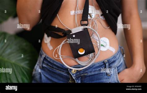 24 Hour Ecg Monitoring And Holter Monitoring On A Woman Body Stock