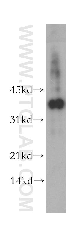 Fgfbp2 Antibody 13254 1 Ap Proteintech