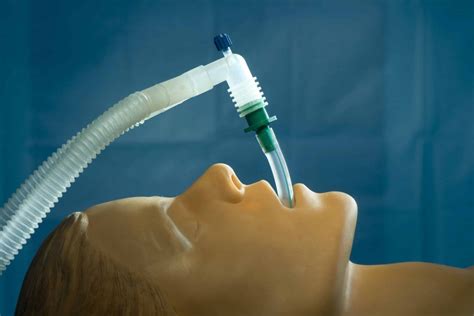 Prone Positioning Decreases Mortality In Severe Ards Hpc