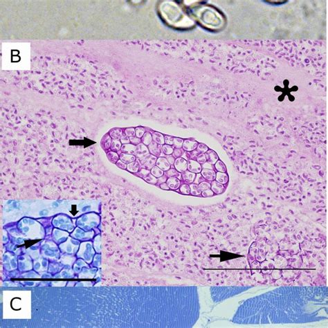 A Fresh Preparation Of Microsporidia Infected Fish Arrow Indicates A