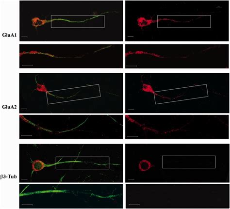 Fluorescence In Situ Hybridization Of Glua1 Glua2 And β3 Tub Mrnas In