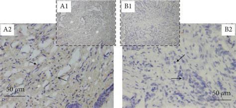 Representative Micrographs Of Immunohistochemically Stained Breast