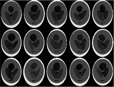 Robust Multimaterial Decomposition Of Spectral Ct Using Convolutional