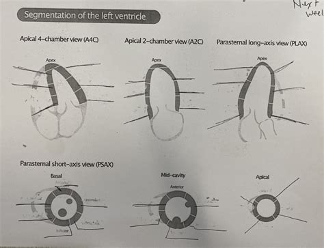 Ventricle Wall Coronary Artery Labeling Diagram Quizlet