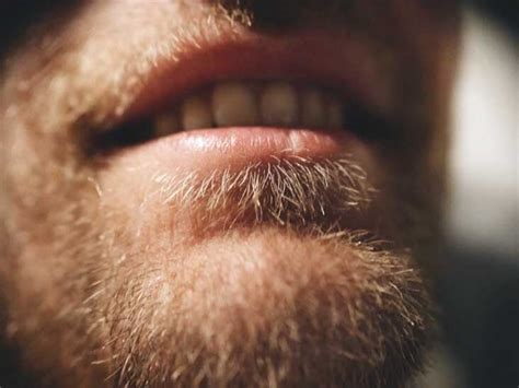 Brown Spots On Lips And Gums Meanings