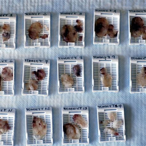 Importance Of Proper Orientation During Embedding Left Gross