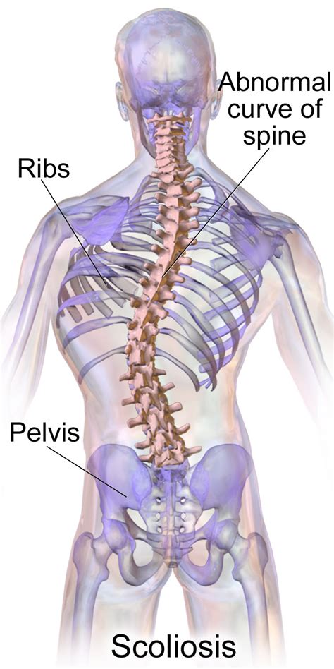 Can Heavy Backpacks Cause Scoliosis SiOWfa14 Science In Our World