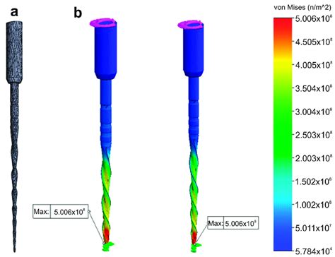 Research Application Finite Elements Analysis Stress Distribution In Download Scientific