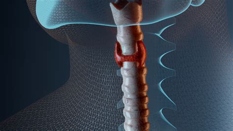 Hyperthyroidismthyroid Storm Nysora