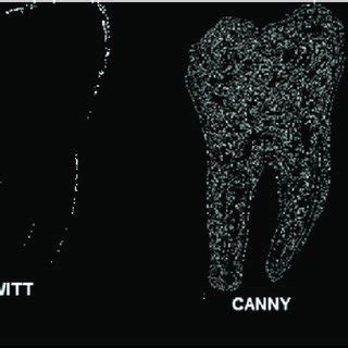 Implementation Of Edge Detection Techniques On Sample R Download Scientific Diagram